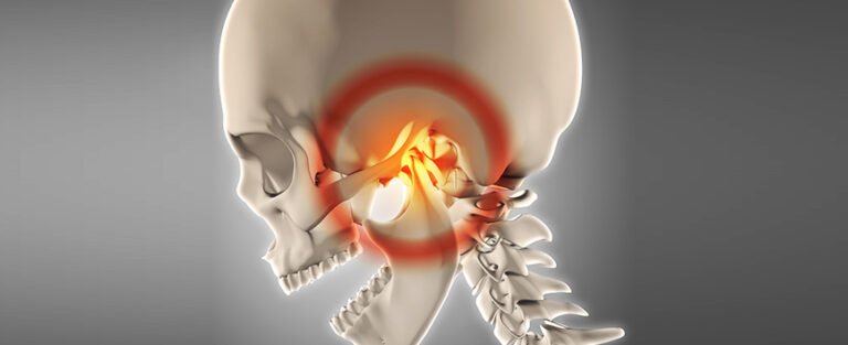 What Is Temporomandibular Disorder (TMD)? | Dentistry & Aesthetics In ...